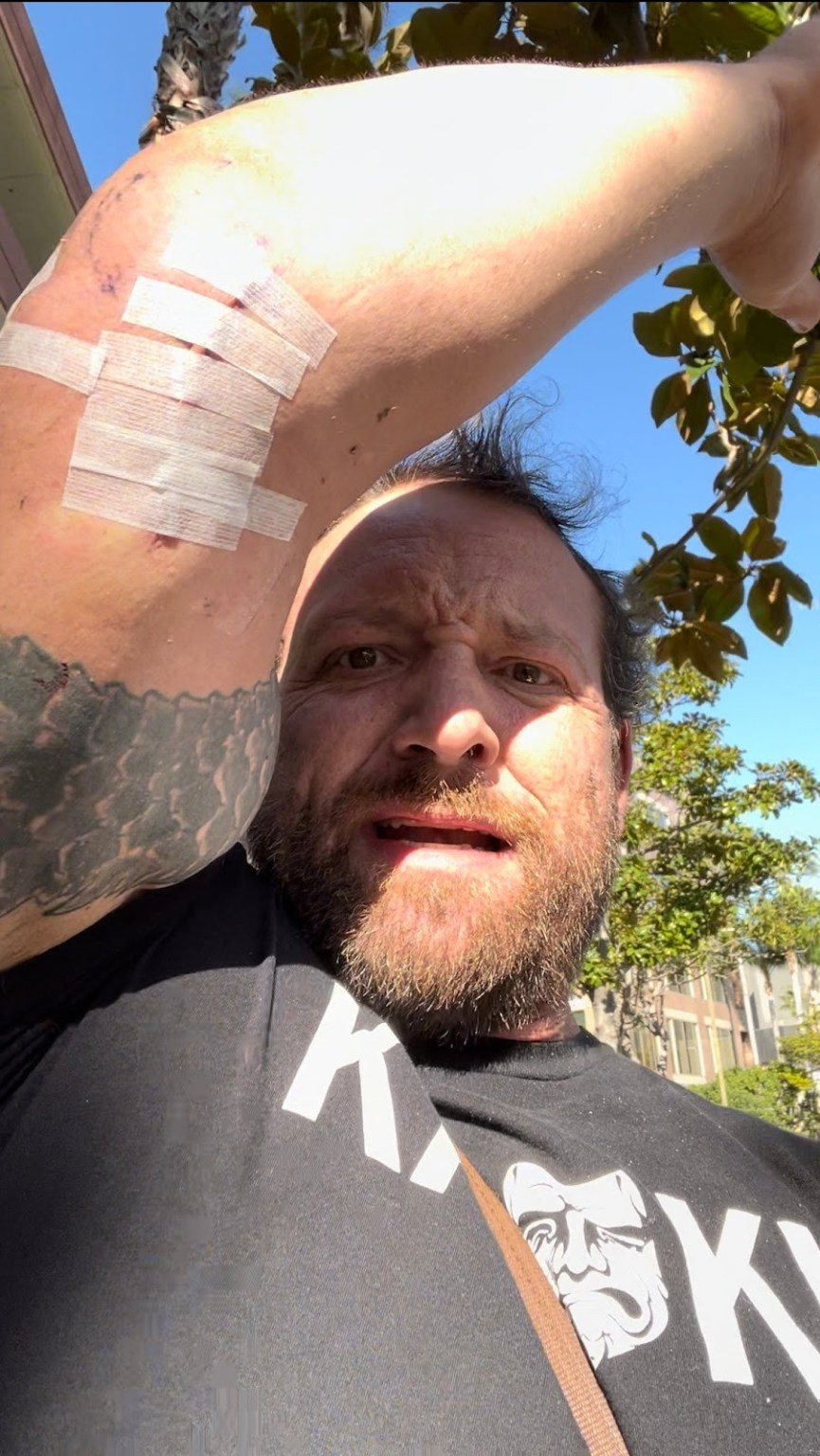 GLOW Peptide Blend for Pre and Post Surgical Recovery: A Regenerative ...