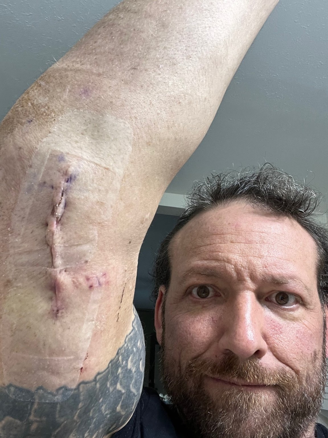 GLOW Peptide Blend for Pre and Post Surgical Recovery: A Regenerative ...